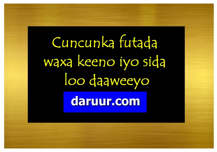 Cuncunka Futada Waxa Keeno Iyo Sida Loo Daaweeyo | Daruur