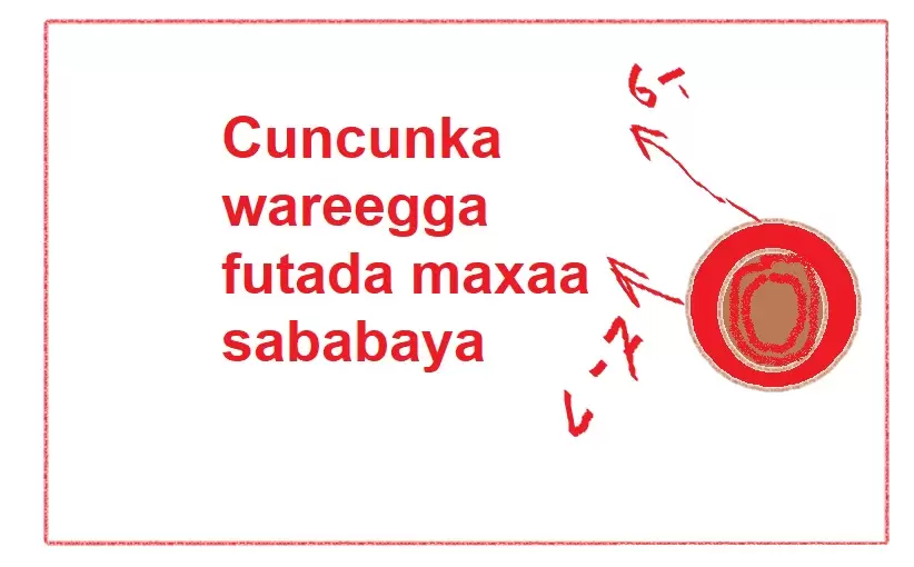 Cuncunka wareegga futada maxaa sababaya