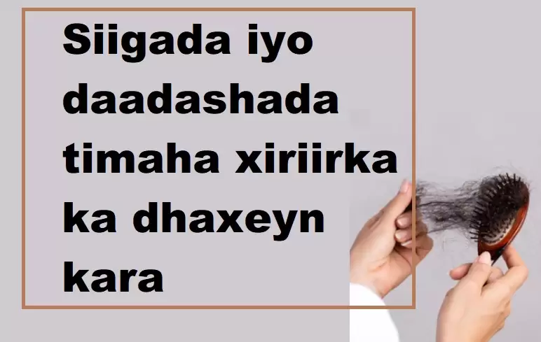 Siigada Iyo Daadashada Timaha Xiriirka Ka Dhaxeyn Kara | Daruur